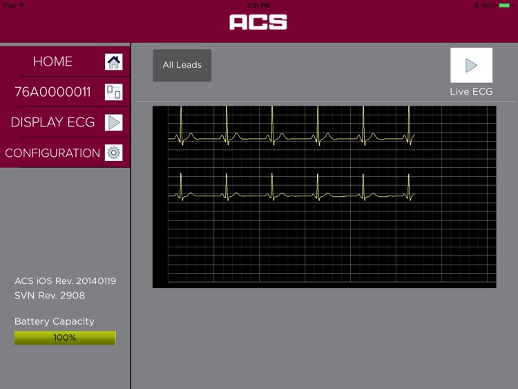 Holter Performer by Applied Cardiac Systems