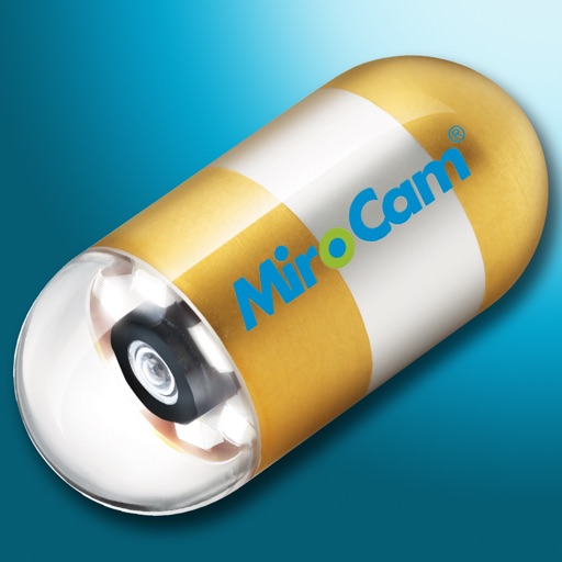 Miro View RTM by Miro View