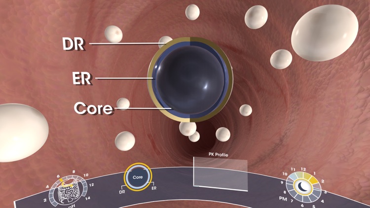 DELEXIS by Ironshore Pharmaceuticals