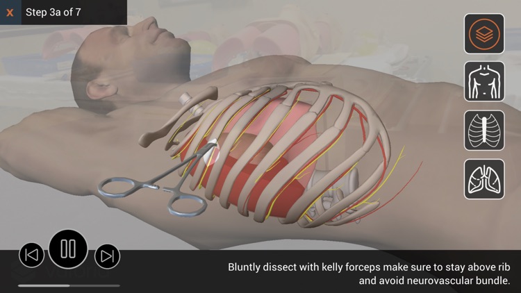 ICC AR Demonstration by Clinical Skills Development Service