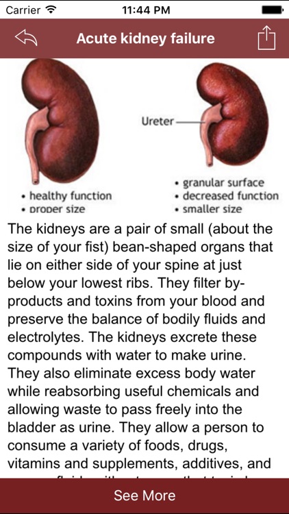 Kidney Conditions & Treatment by Dimple Shah