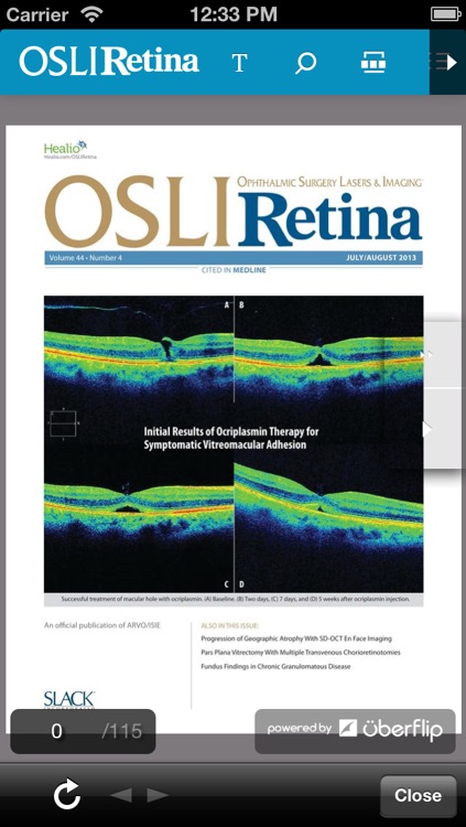 OSLI Retina by The Wyanoke Group