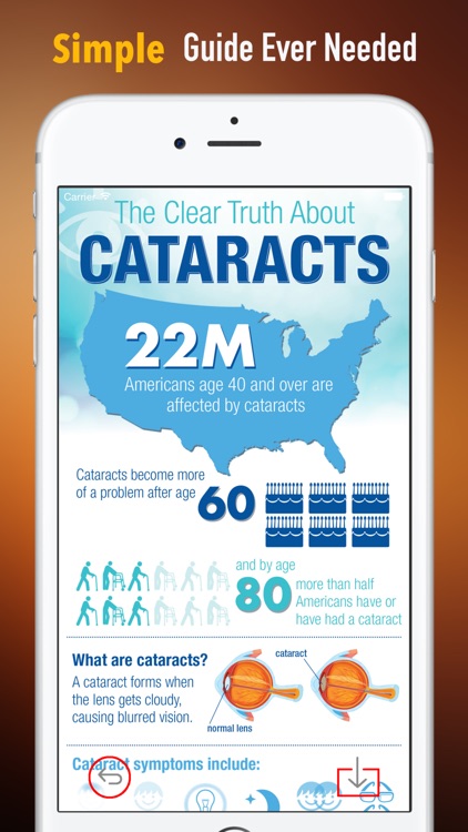 Cataract 101: Prevention Tips and Treatment Tutorial by Steve Chang